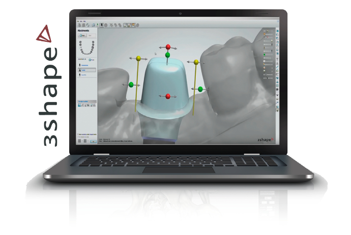 Descargar libreria Exocad | NetPlus Dental